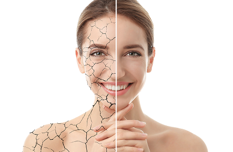 Dry Skin vs Dehydrated Skin: How to Tell the Difference – Dr Sabrina™