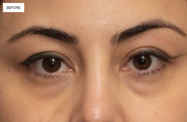 Perfect 360 Eye Illuminate - Dr Sabrina™