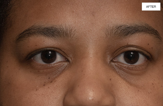 Best Eye Care Products for Under Eye Concerns - Dr Sabrina™